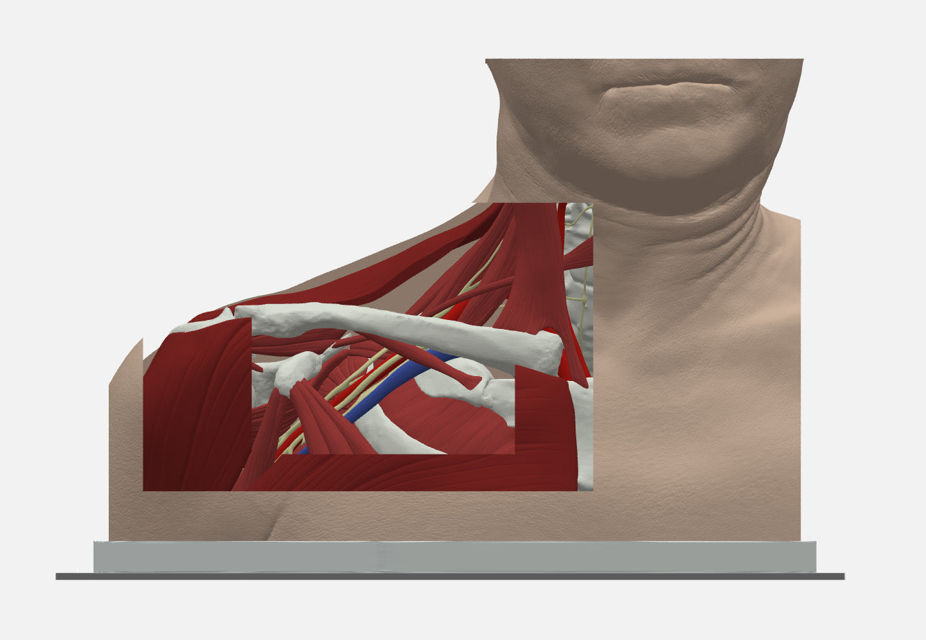 Custom 3D Anatomy Models | Thoracic Outlet Syndrome (TOS) | Thoracic ...