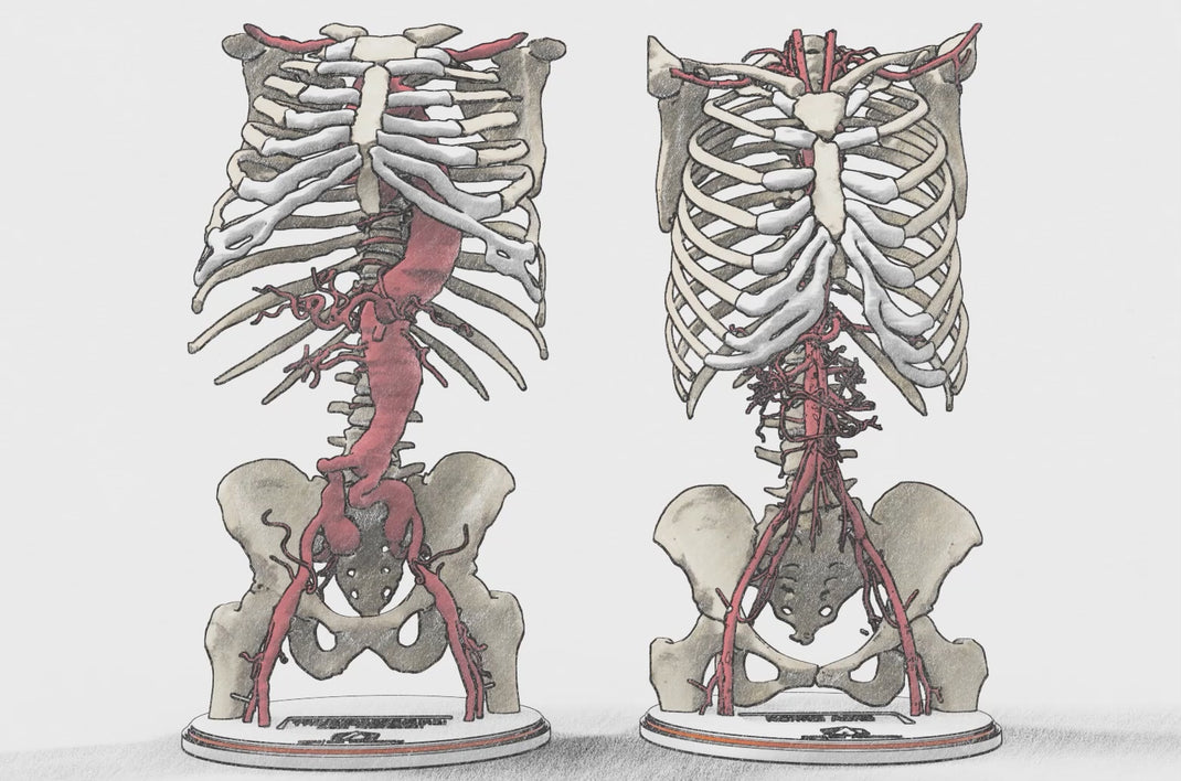 3D Printing Anatomical Models | GPI 3D Anatomy