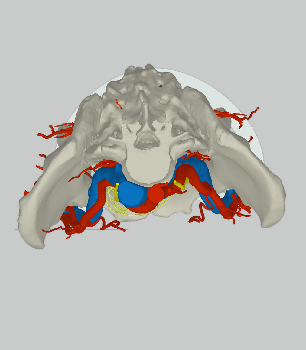 Custom 3D Anatomy Models | Perineal Hernia | Pelvic Floor Dysfunction ...