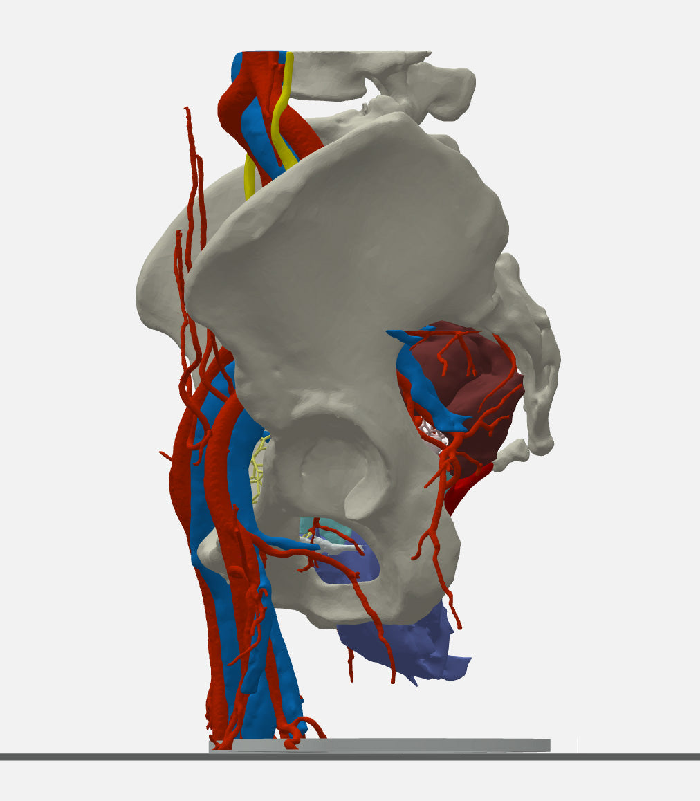 Custom 3D Anatomy Models | Perineal Hernia | Pelvic Floor Dysfunction ...