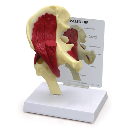Muscled Hip Education Card – GPI 3D Anatomy