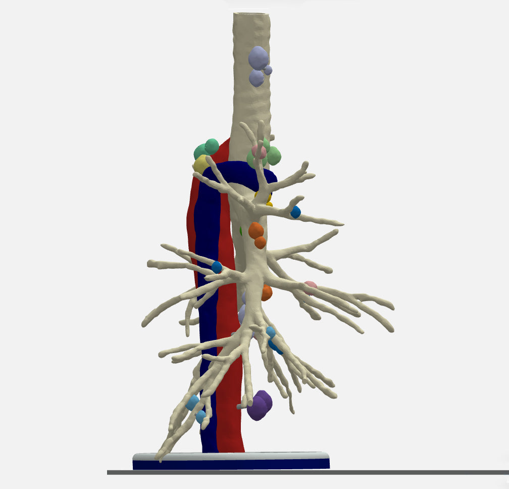 Custom 3D Anatomy Models | Tracheobronchial Tree With Lymph Nodes ...