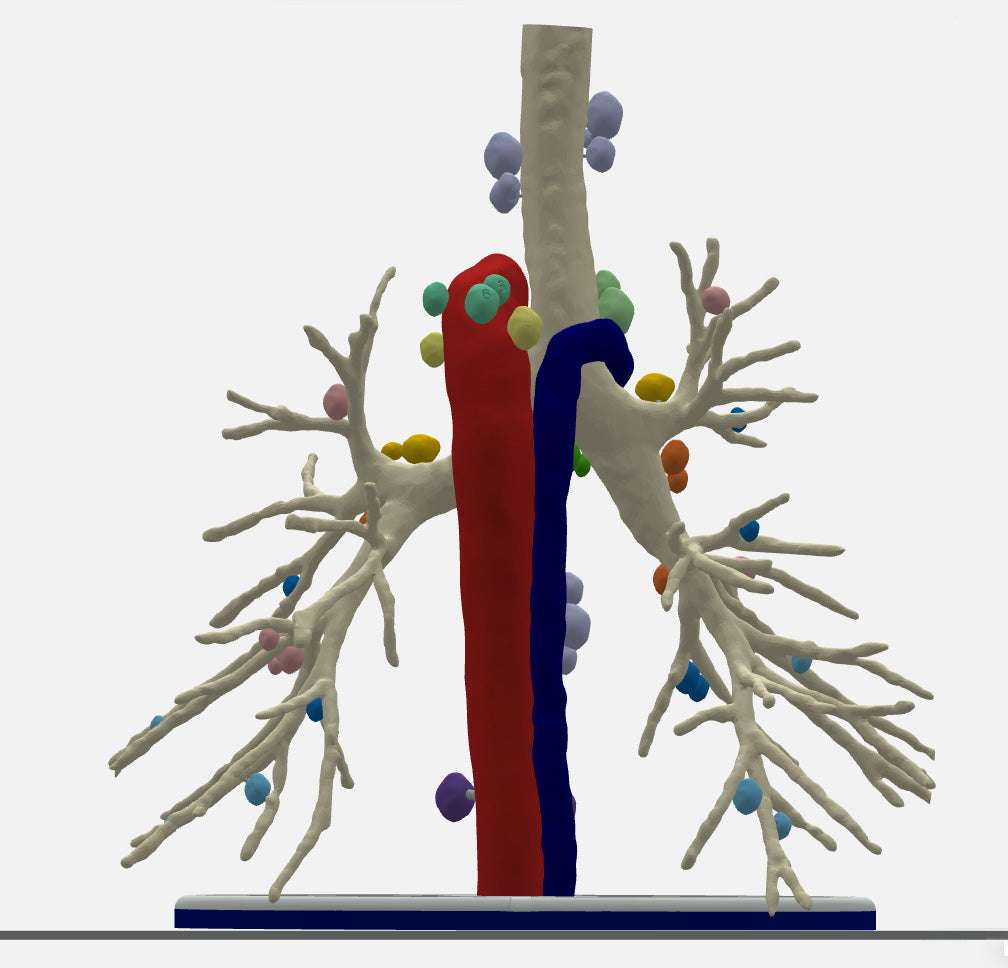 Custom 3D Anatomy Models | Tracheobronchial Tree With Lymph Nodes ...
