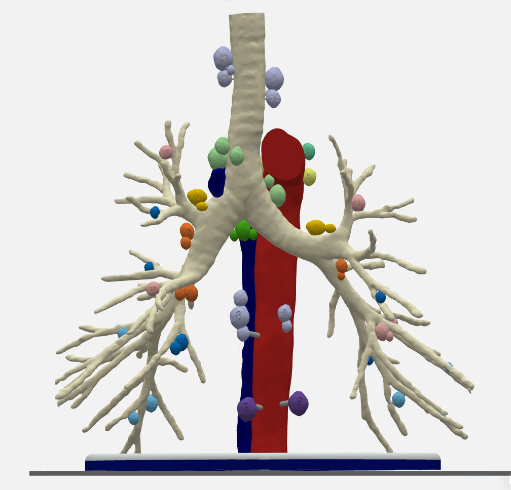 Custom 3D Anatomy Models | Tracheobronchial Tree With Lymph Nodes ...